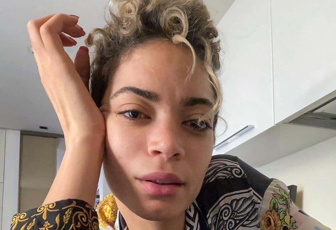 Elodie Con Madame: Ecco Due Nuove Versioni Di Andromeda